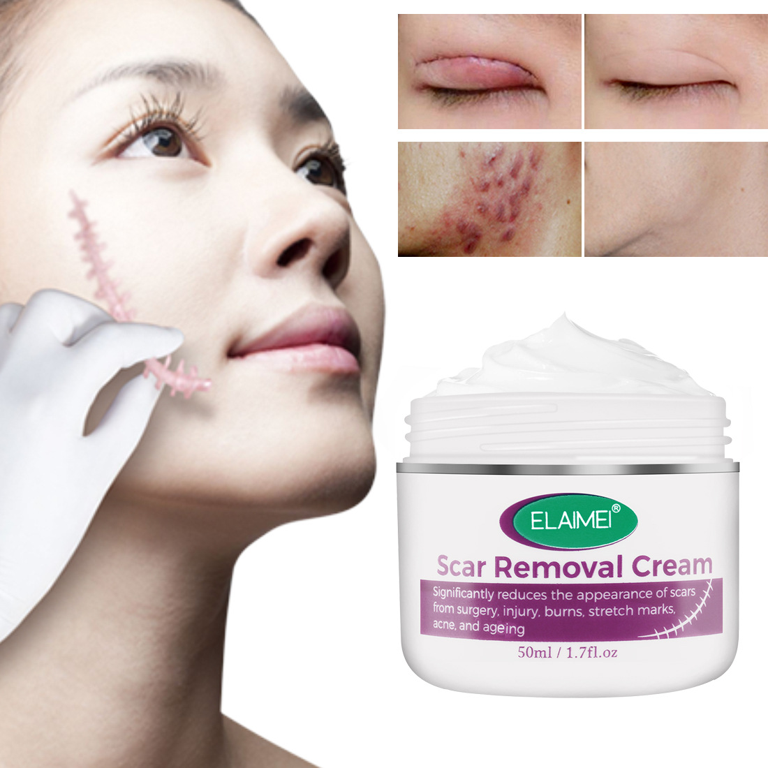 Buy ELAIMEI bottled scar cream fades and smoothes scars without scars ...